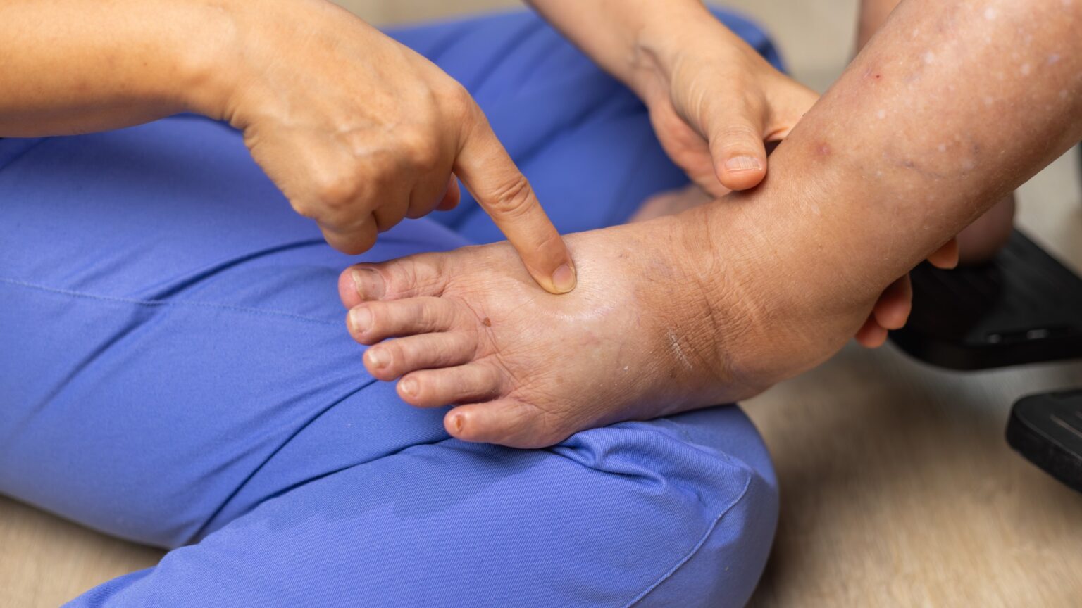 Foot Care for Diabetic Patients – Don’t Ignore Small Wounds - Aditya ...